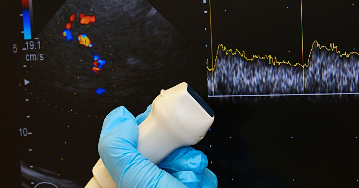 The Highest-Paying Sonography Specialties in 2024 | Vivian Community Hub